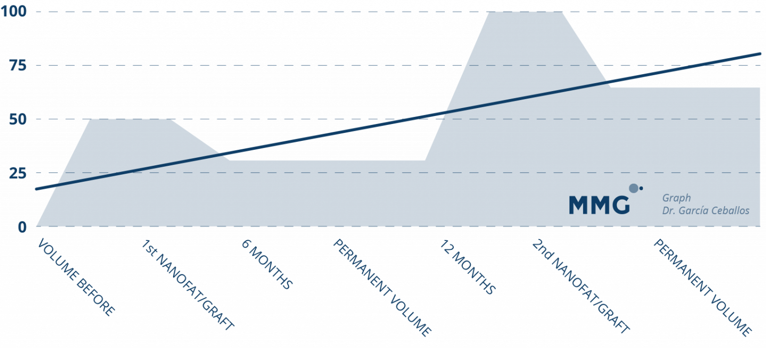 Liposuction and Fat transfer - Plastic, aesthetic and reconstructive ...